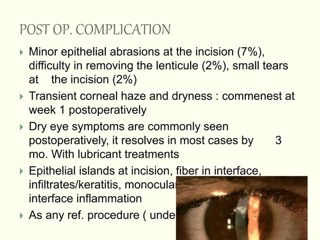Just SMILE (small incision lenticule extraction ) | PPTX | Eye and ...