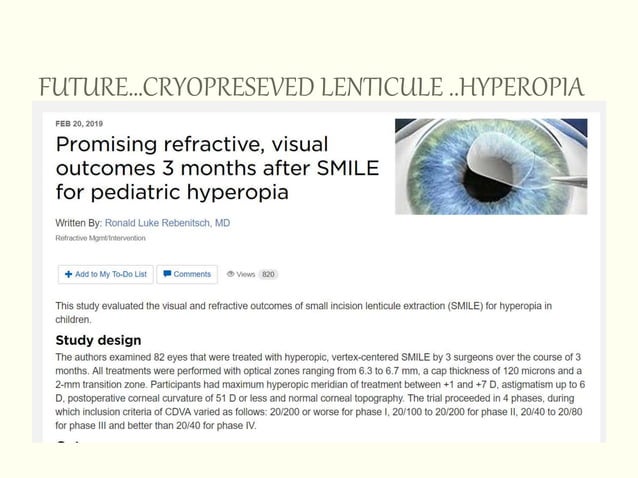 Just SMILE (small incision lenticule extraction ) | PPTX | Eye and ...