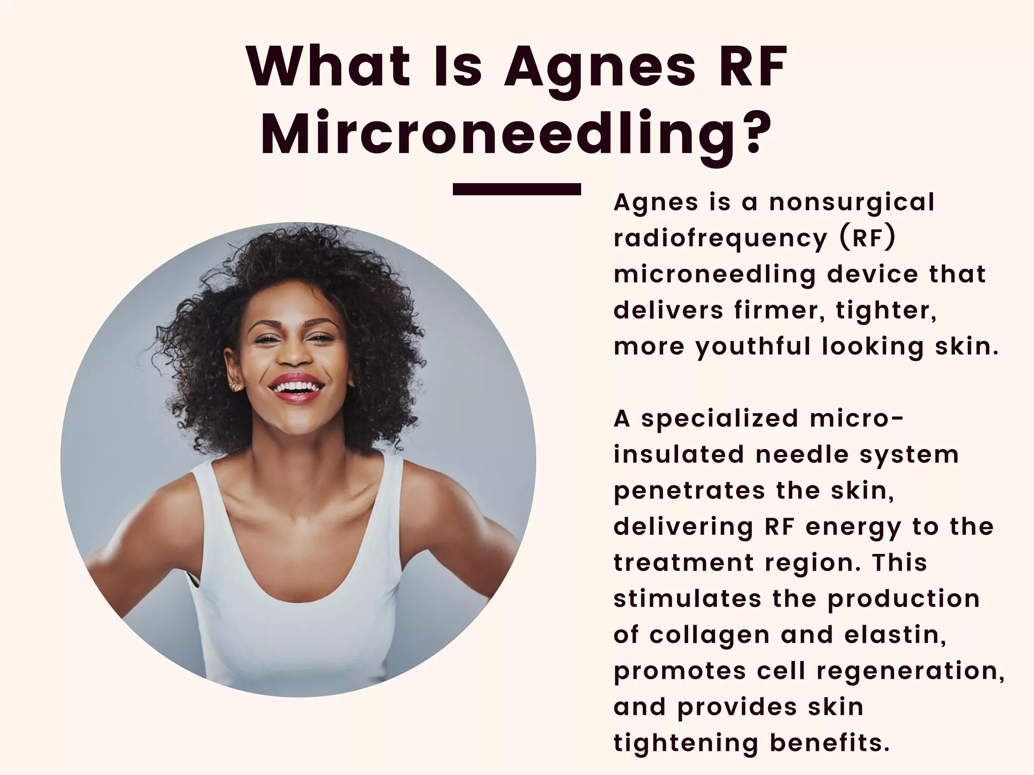 Your Guide to Agnes RF Microneedling Treatments | PDF