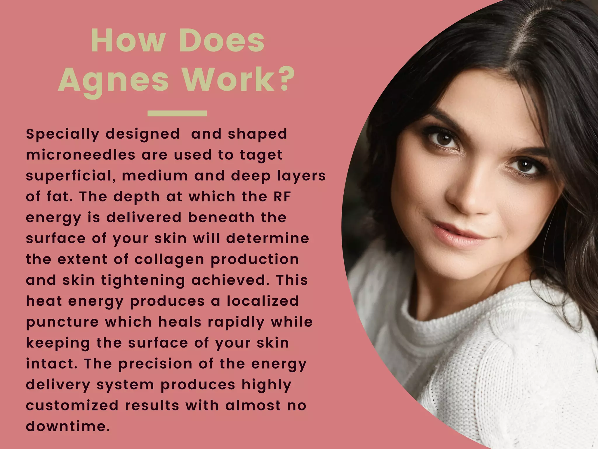 Your Guide to Agnes RF Microneedling Treatments | PDF