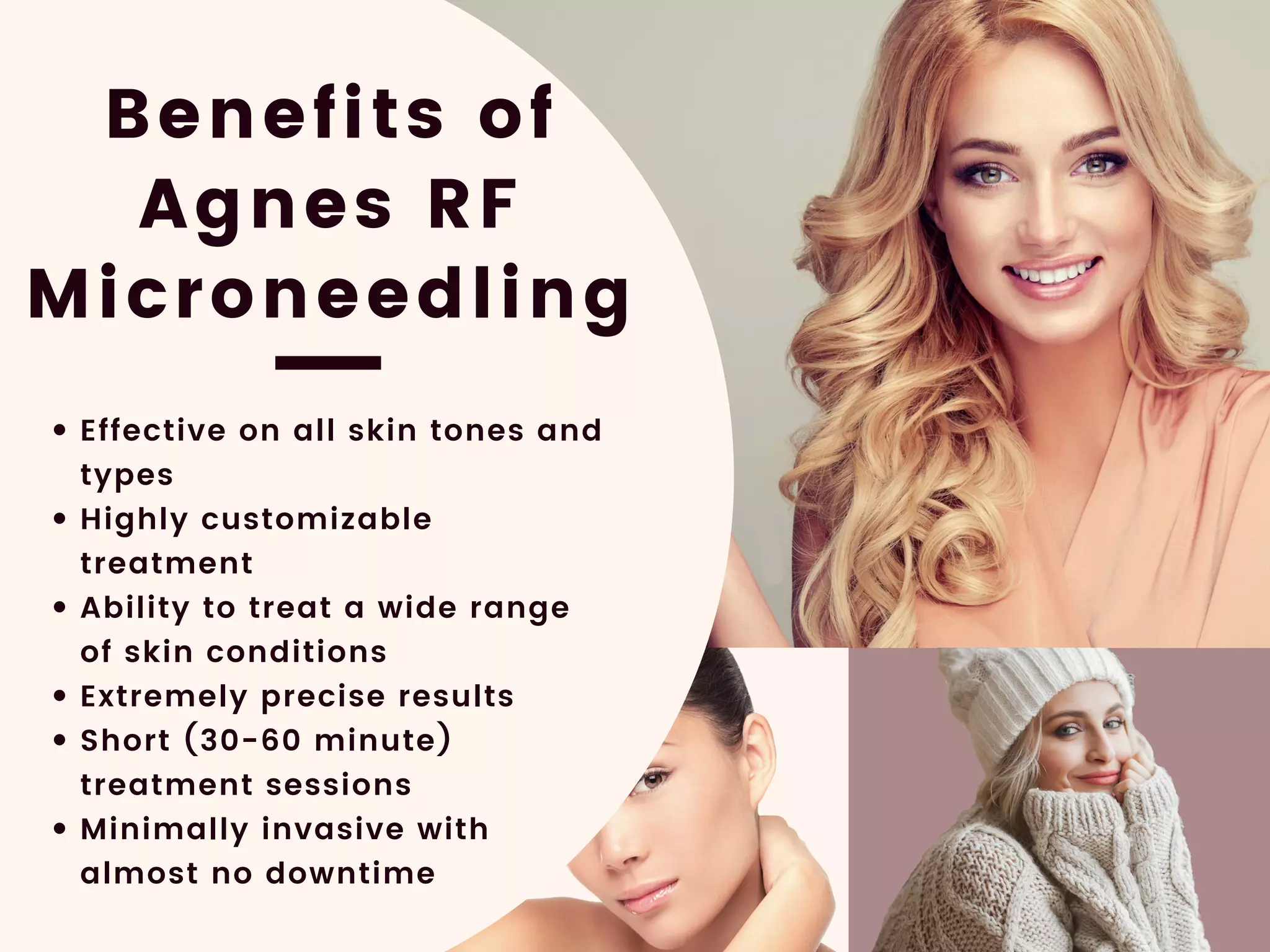 Your Guide to Agnes RF Microneedling Treatments | PDF
