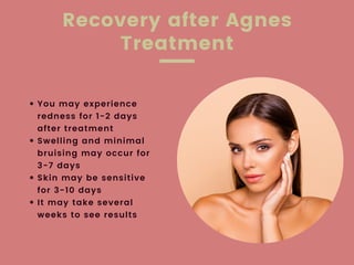 Your Guide to Agnes RF Microneedling Treatments | PDF