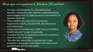 Juvenile idiopathic arthritis | PDF