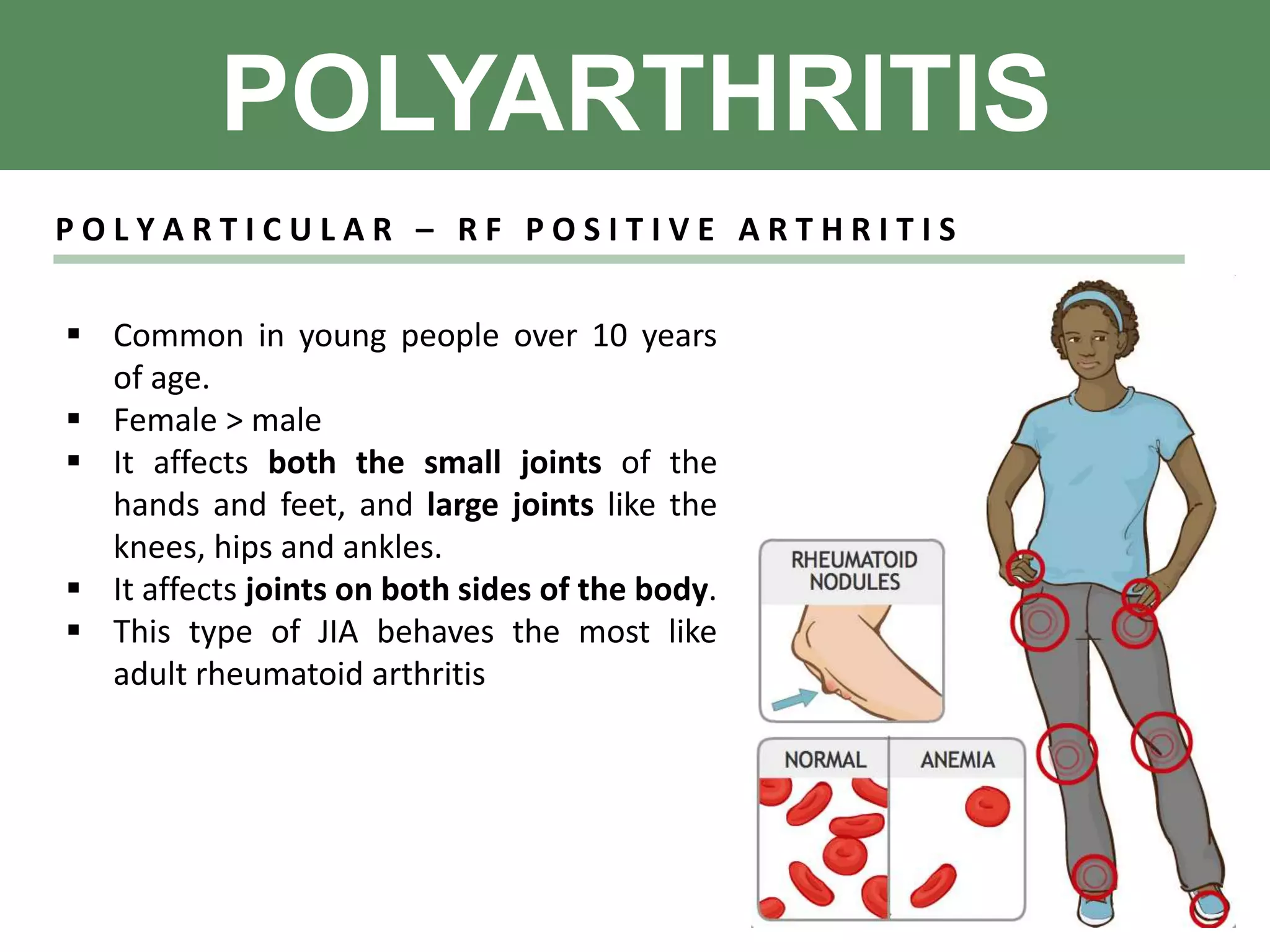 Juvenile idiopathic arthritis (JIA) | PPTX