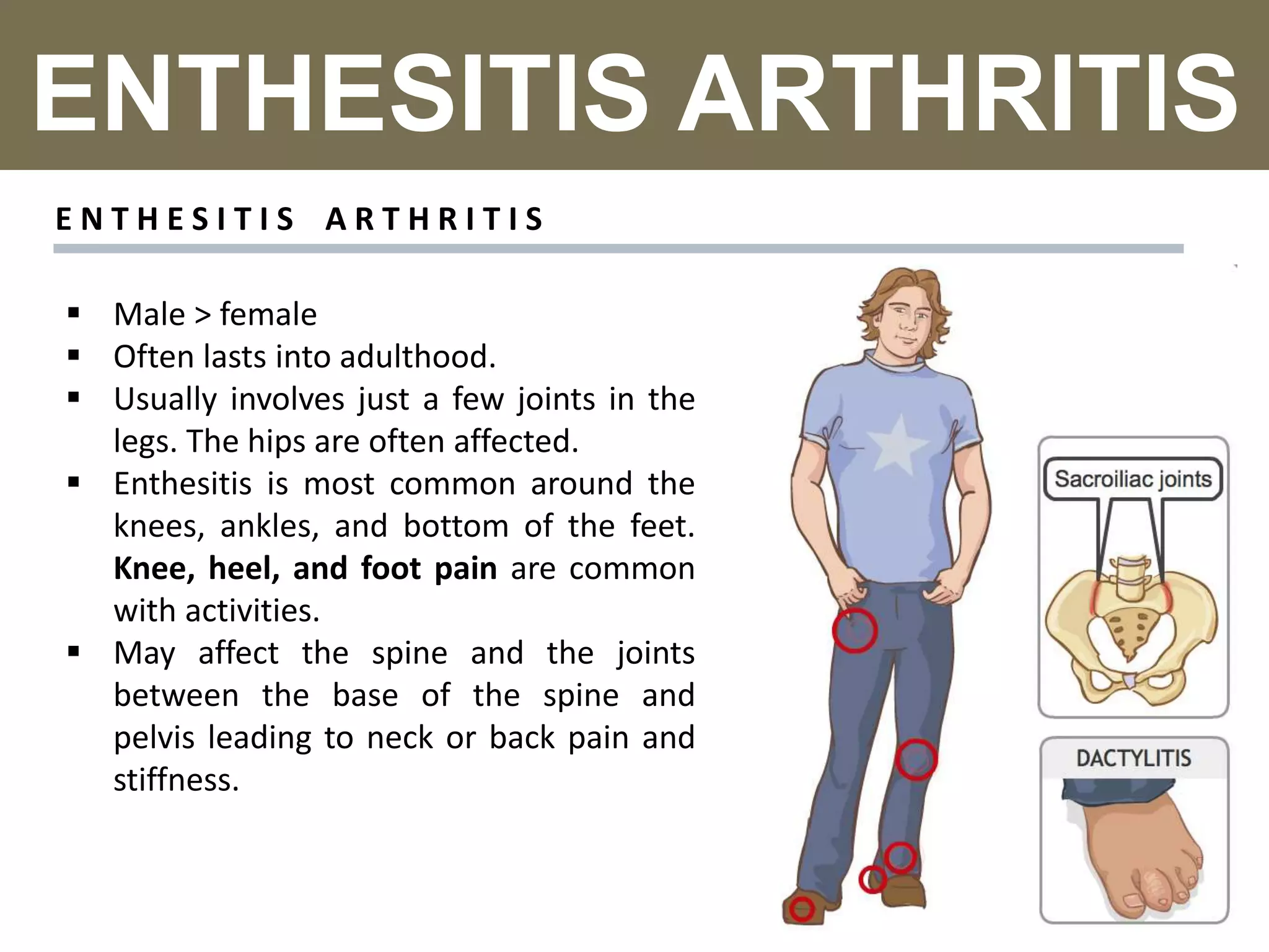 Juvenile idiopathic arthritis (JIA) | PPTX