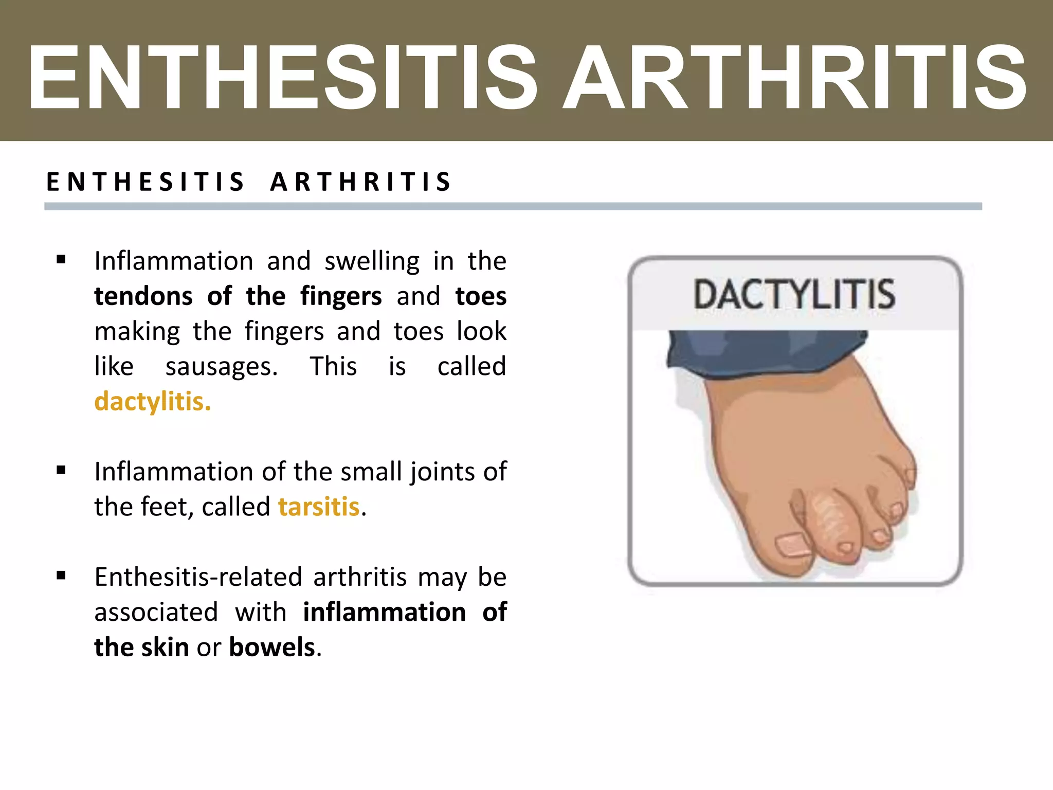 Juvenile idiopathic arthritis (JIA) | PPTX