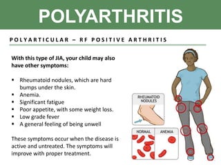 Juvenile idiopathic arthritis (JIA) | PPTX
