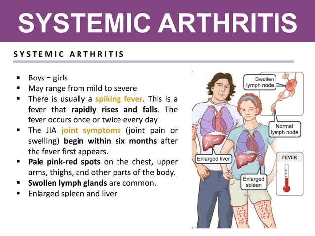 Juvenile idiopathic arthritis (JIA) | PPTX | Bone and Joint Conditions | Diseases and Conditions