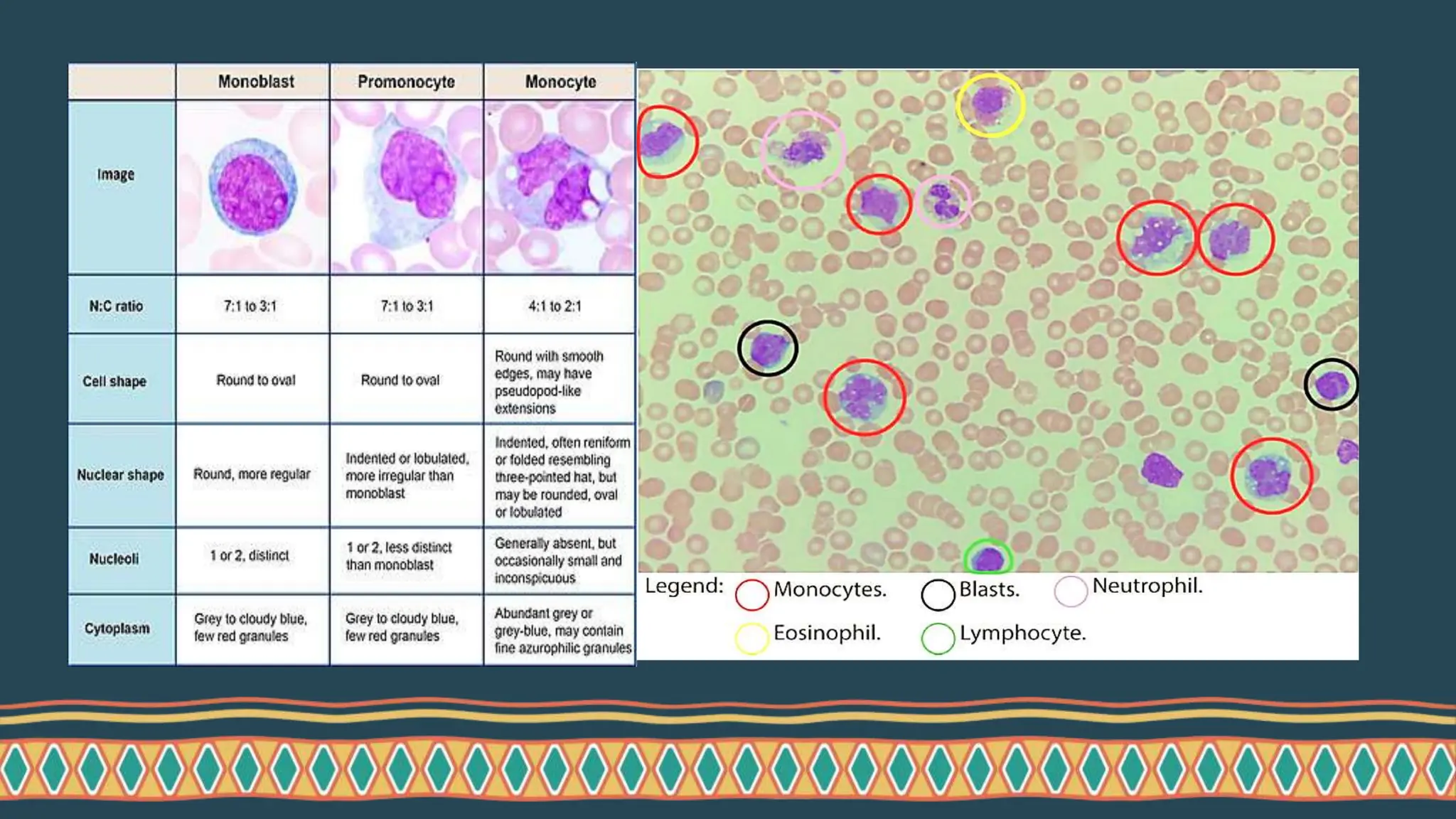 Juvenile Myelomonocytic Leukemia (JMML) | PPTX