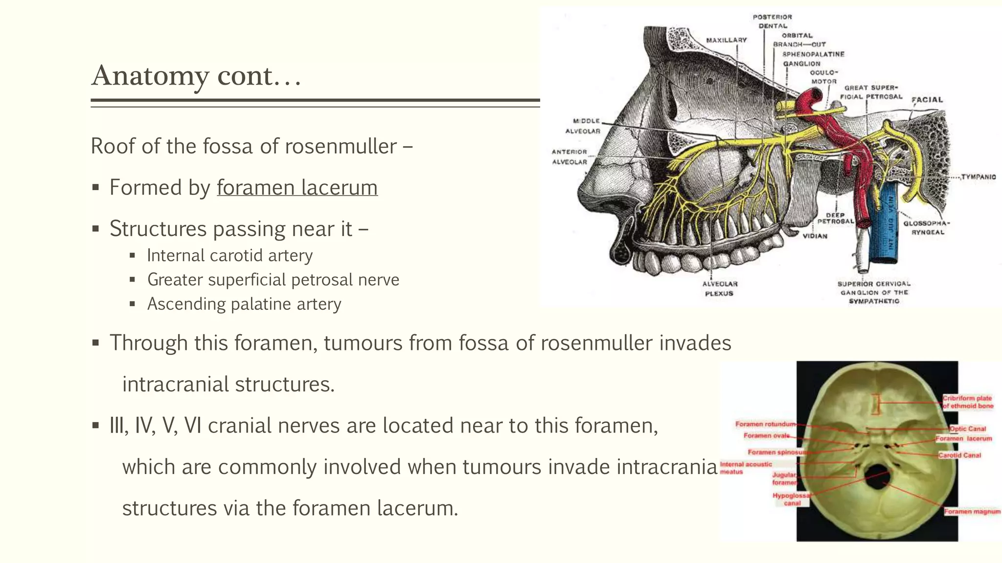 Juvenile nasopharyngeal angiofibroma | PPTX