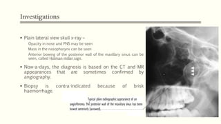 Juvenile nasopharyngeal angiofibroma | PPTX