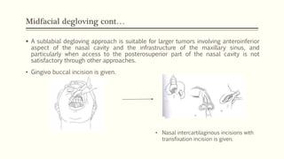 Juvenile nasopharyngeal angiofibroma | PPTX