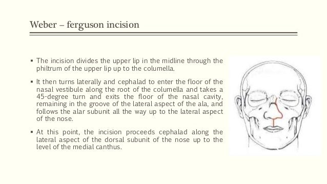Juvenile nasopharyngeal angiofibroma