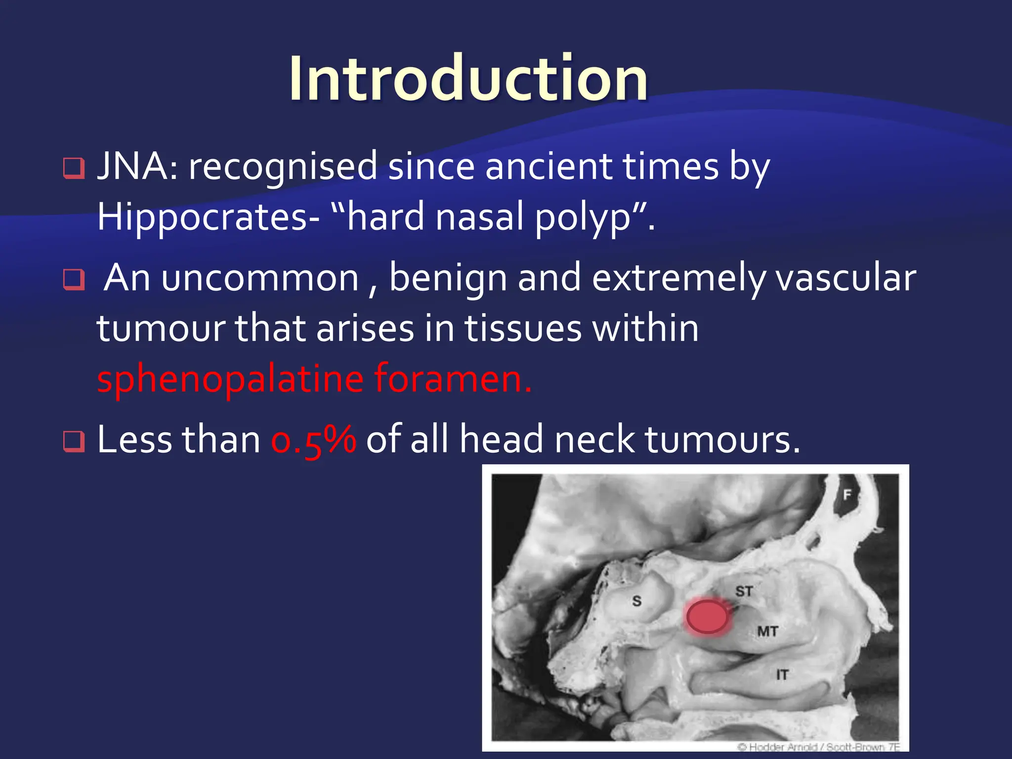 Juvenile nasopharyngeal angiofibroma 1.pptx
