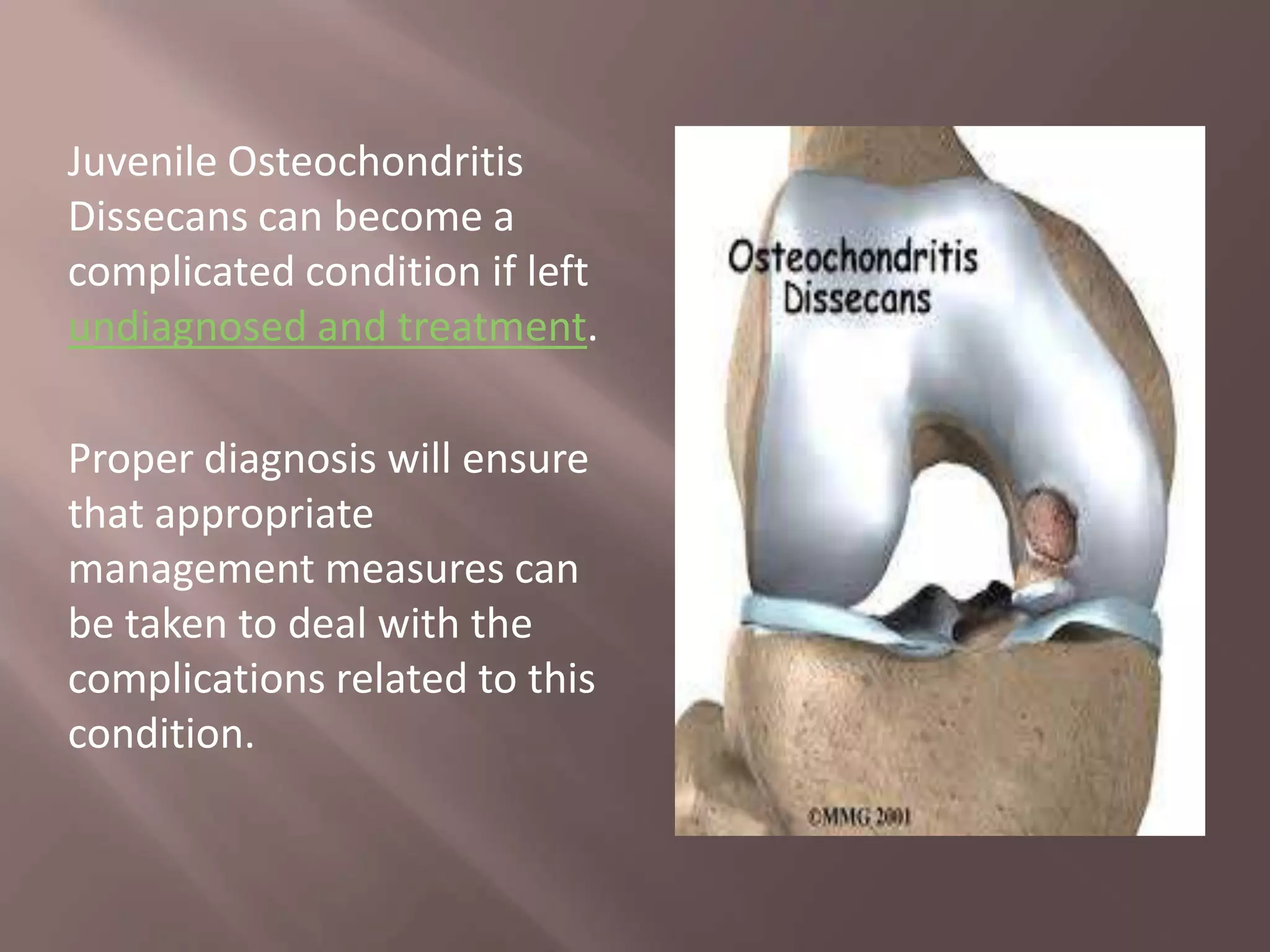 Juvenile osteochondritis dissecans | PPT