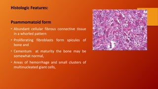 Juvenile Ossifying Fibroma | PPTX