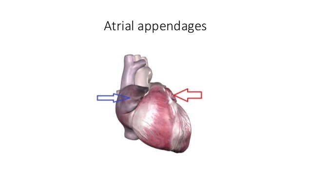 Juxtaposed atrial appendages