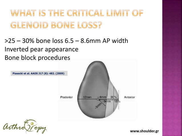 Traumatic shoulder dislocation 2017 kat | PPT