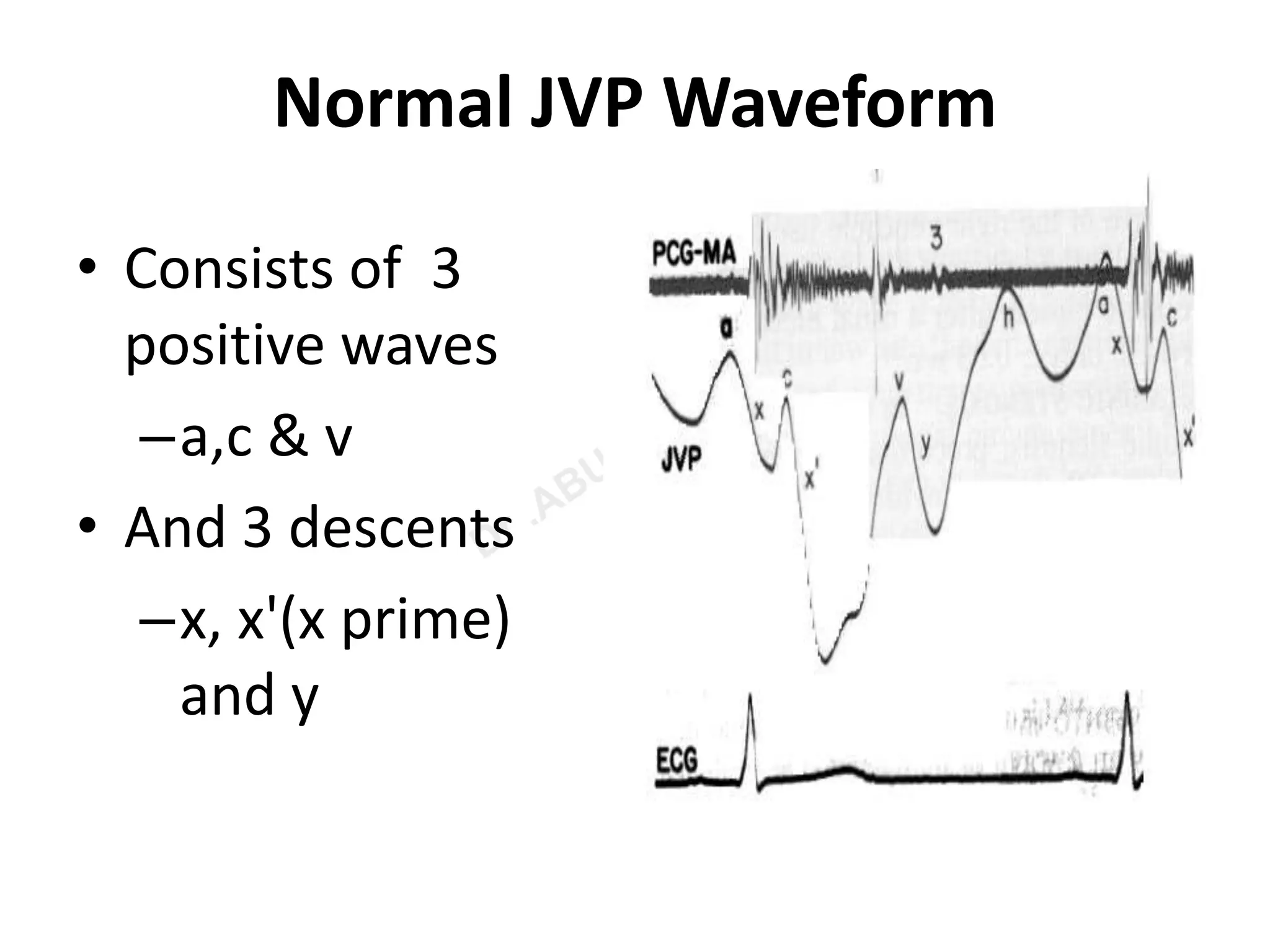 EVERYTHING ABOUT JVP | PPTX