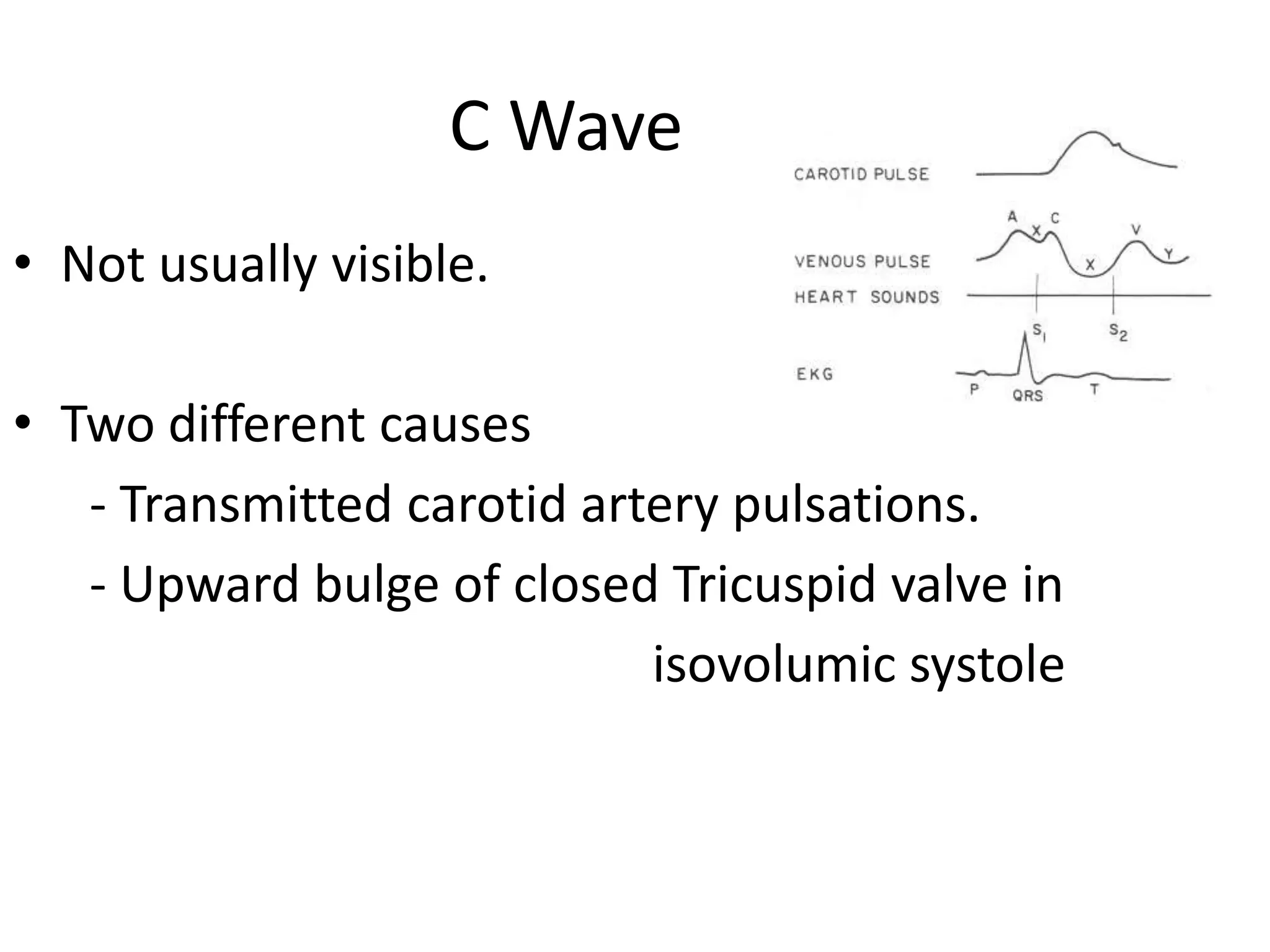 JVP AND WAVEFORMS.ppt
