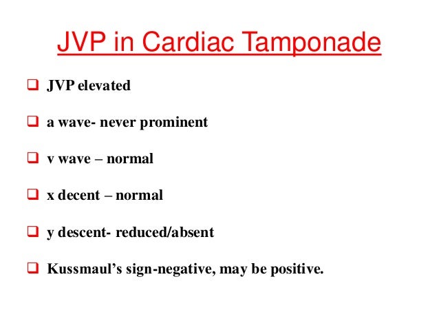 jugular venous pressure