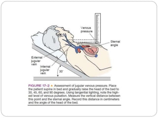 Jugular Venous Pressure | PPTX