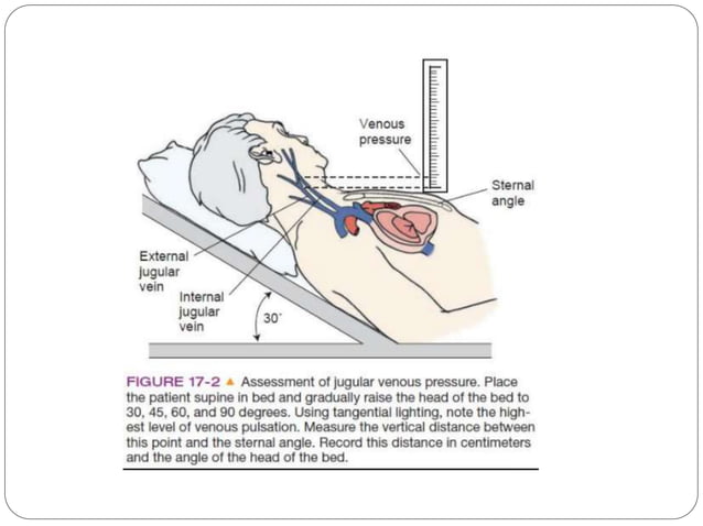 Jugular Venous Pressure | PPTX