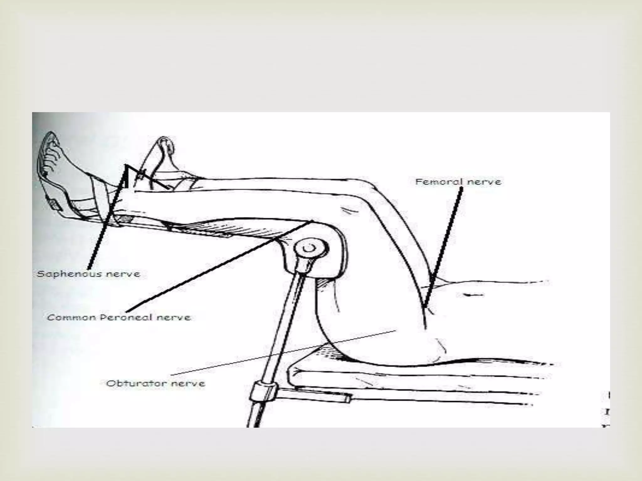 Lithotomy position abdullah | PPTX