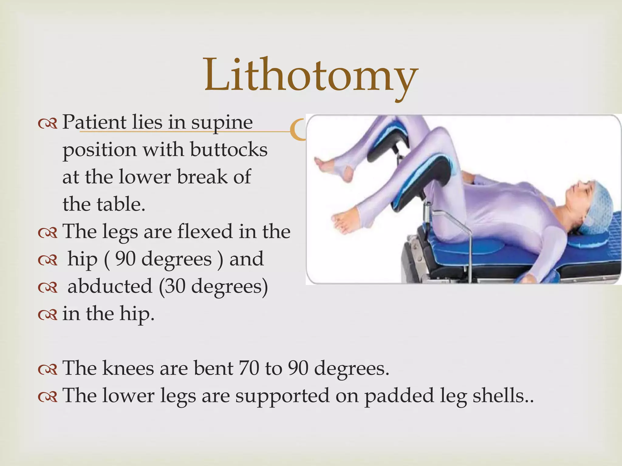 Lithotomy position abdullah | PPTX