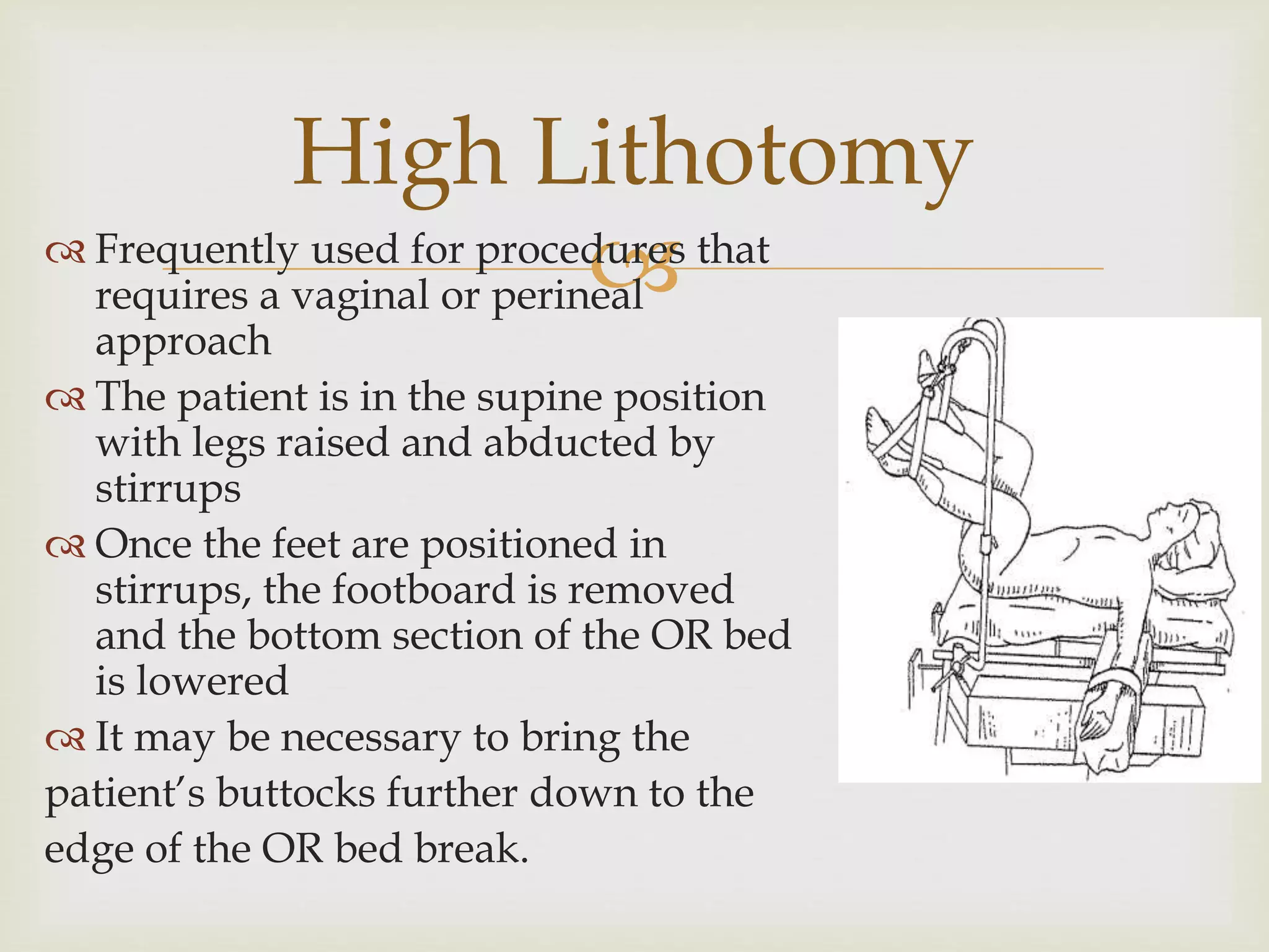 Lithotomy position abdullah | PPTX