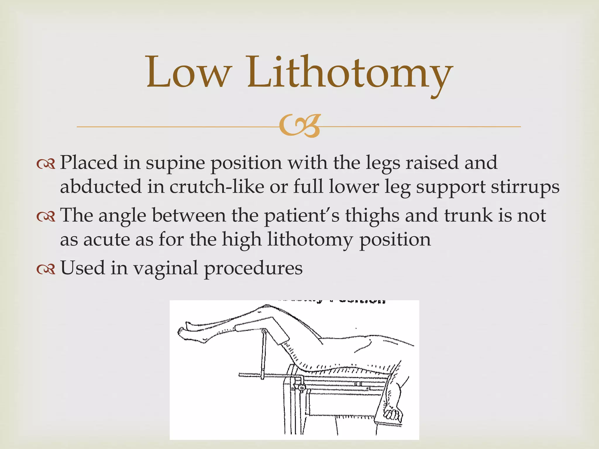 Lithotomy position abdullah | PPTX