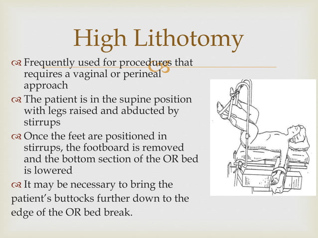 Lithotomy position abdullah | PPTX