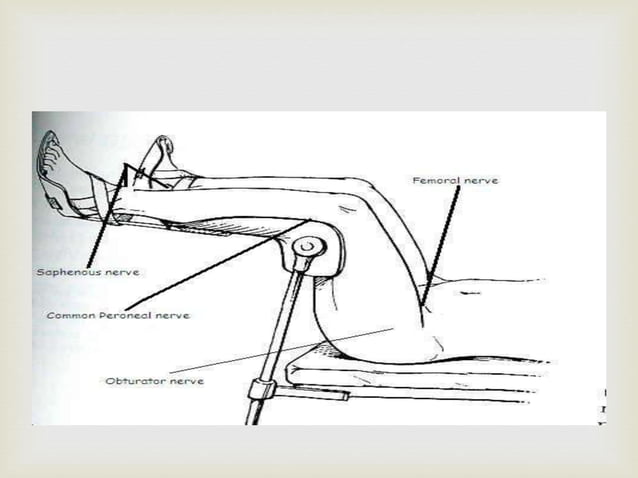 Lithotomy position abdullah | PPT