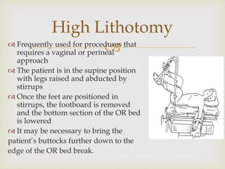 Lithotomy position abdullah | PPT