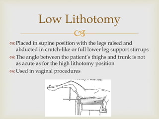 High Lithotomy Position