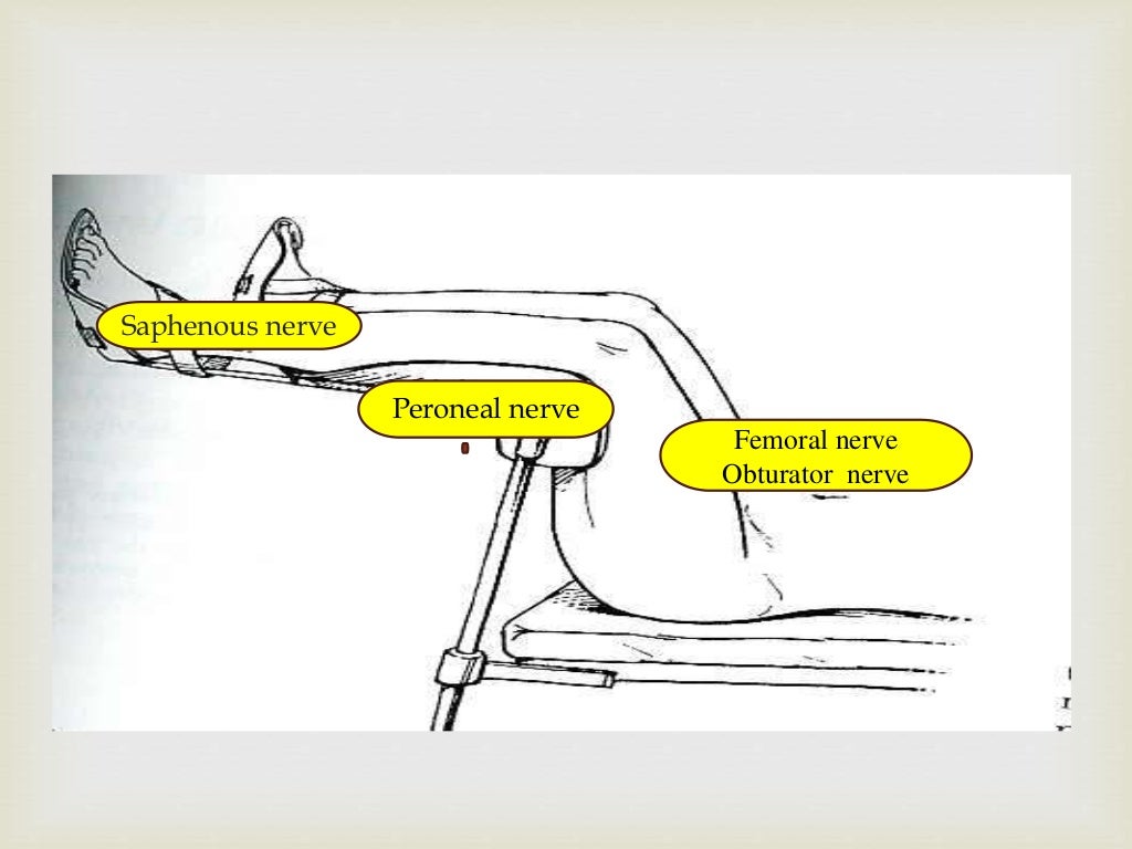 Lithotomy position abdullah