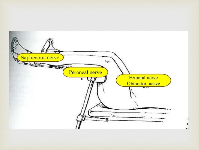 Lithotomy position abdullah