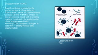 Antigen antibody diseases diagnosis technique | PPTX