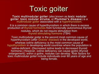 toxic goiter | PPT