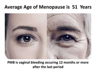 Panel Discussion on Post Menopausal Bleeding | PPTX