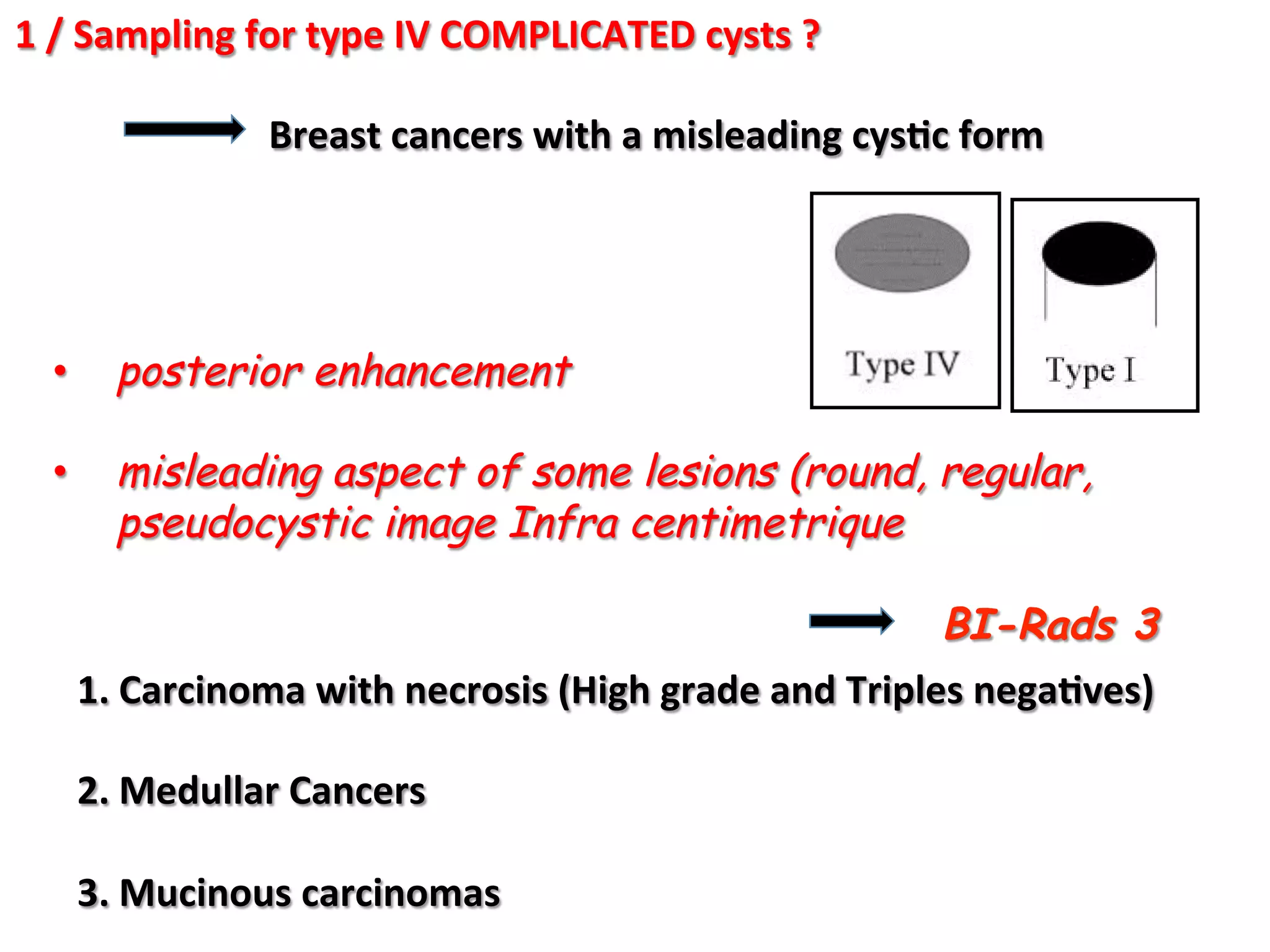 Jy seror breast cyst benign or malignant jfim hanoi 2015 | PDF