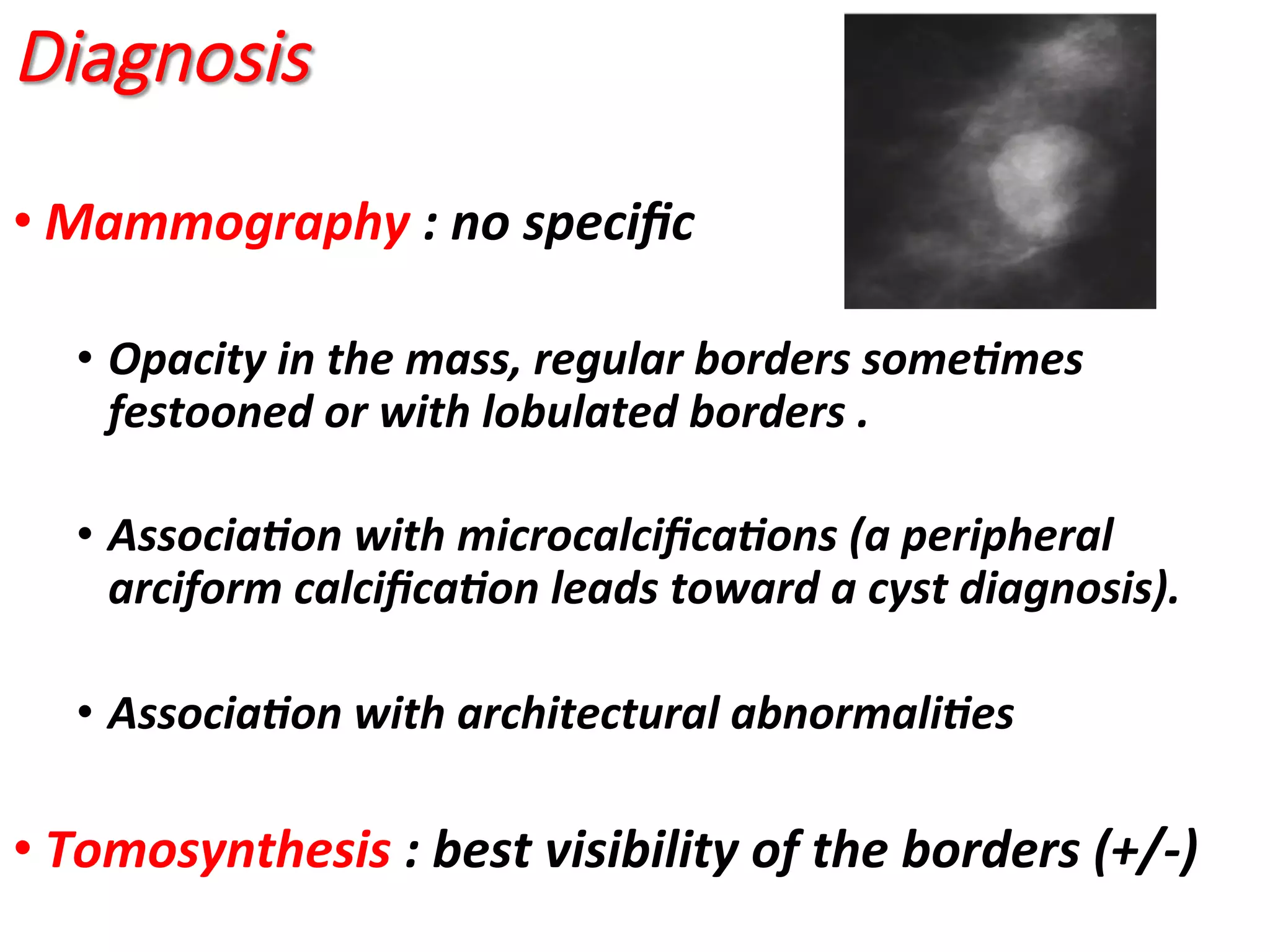 Jy seror breast cyst benign or malignant jfim hanoi 2015 | PDF