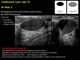 Breast Cyst Ultrasound