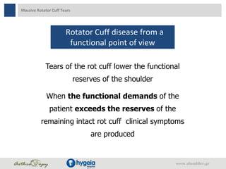 Massive rct salonica 2106 | PPTX