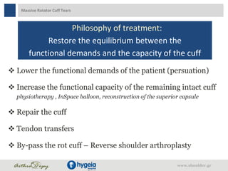 Massive rct salonica 2106 | PPTX