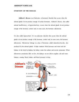 Addison Disease Pathophysiology