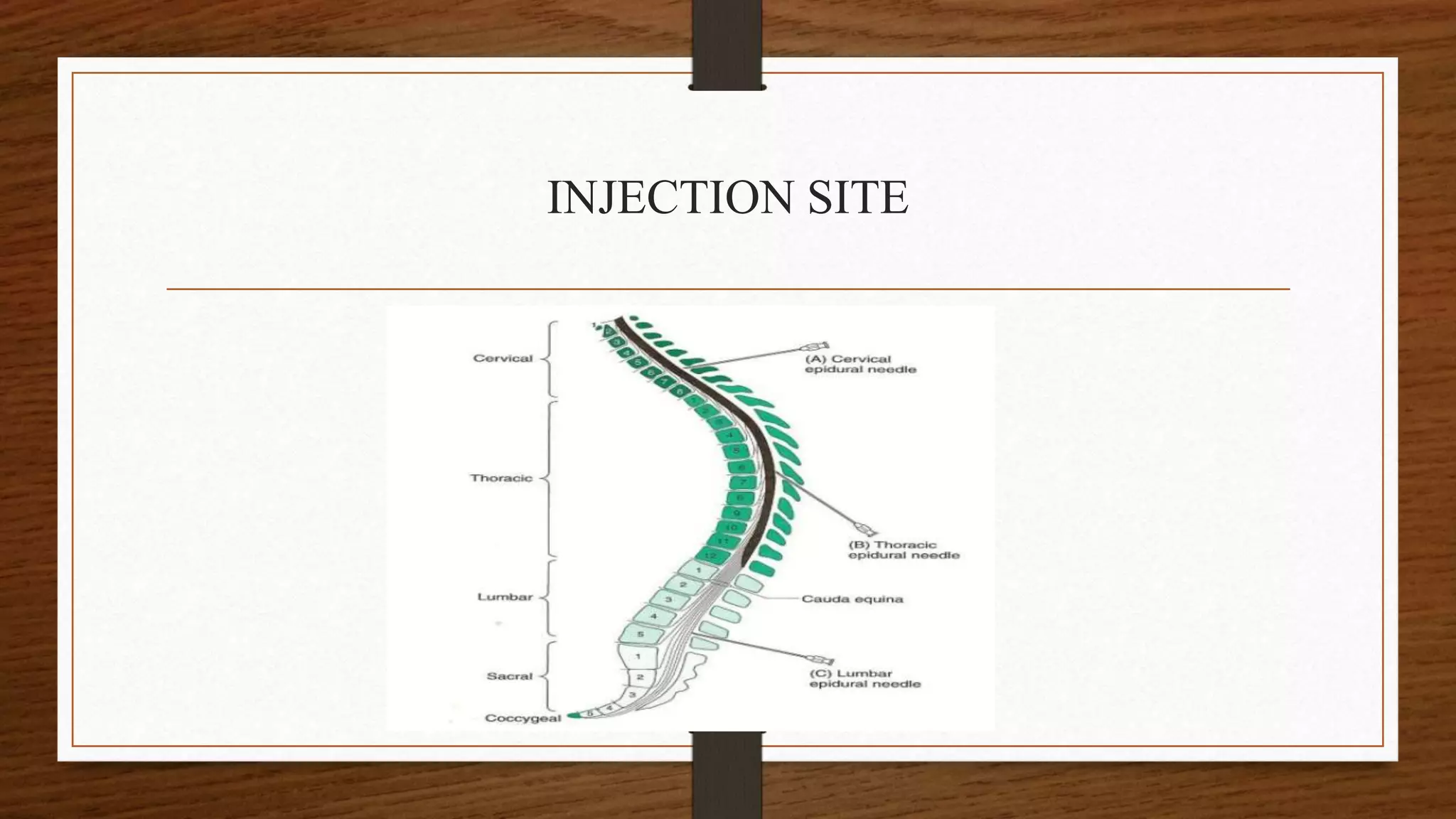 K. Mohan Epidural Anesthesia Presentation | PPTX