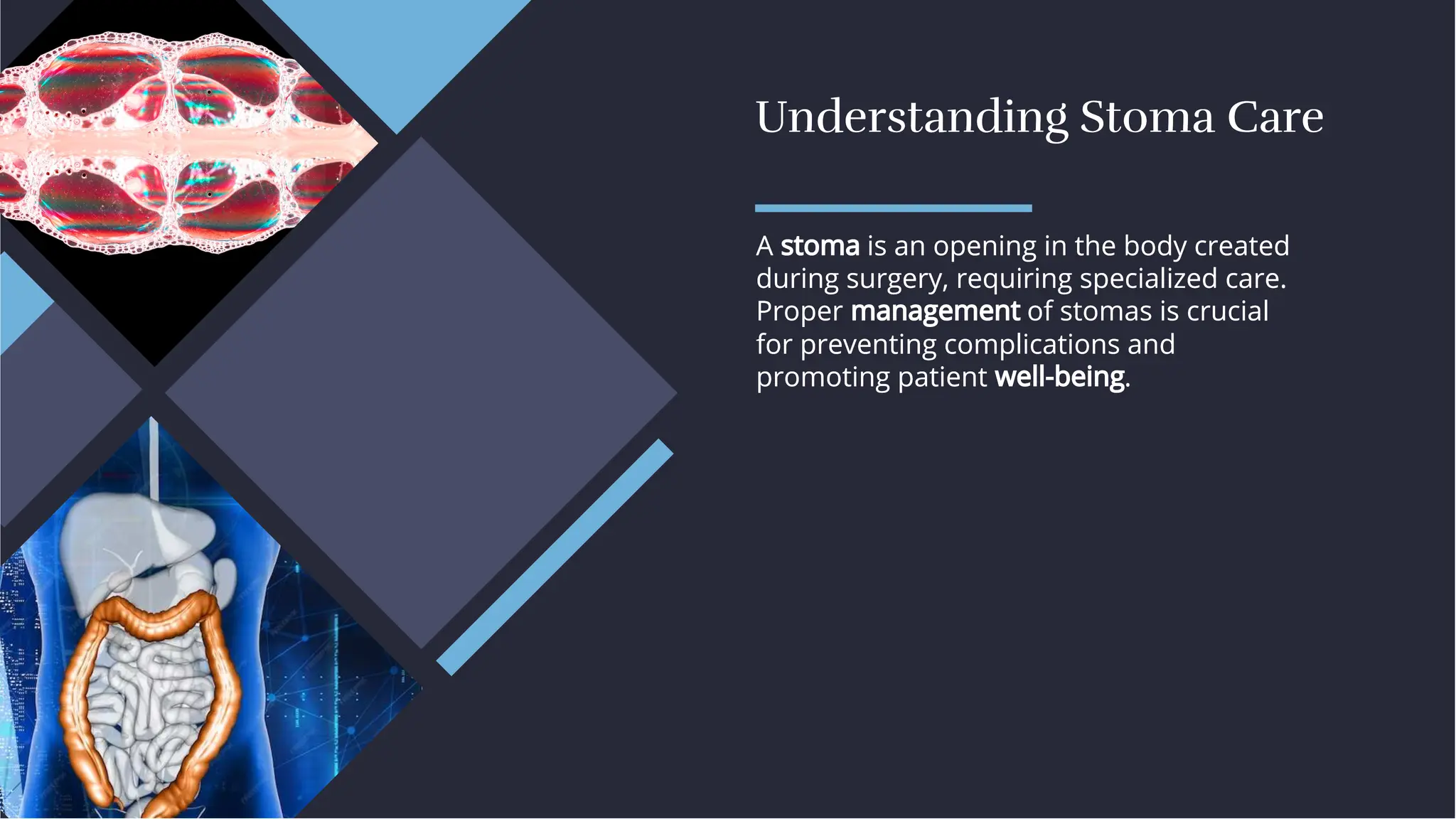 Stoma care presentation nursing guide and | PDF