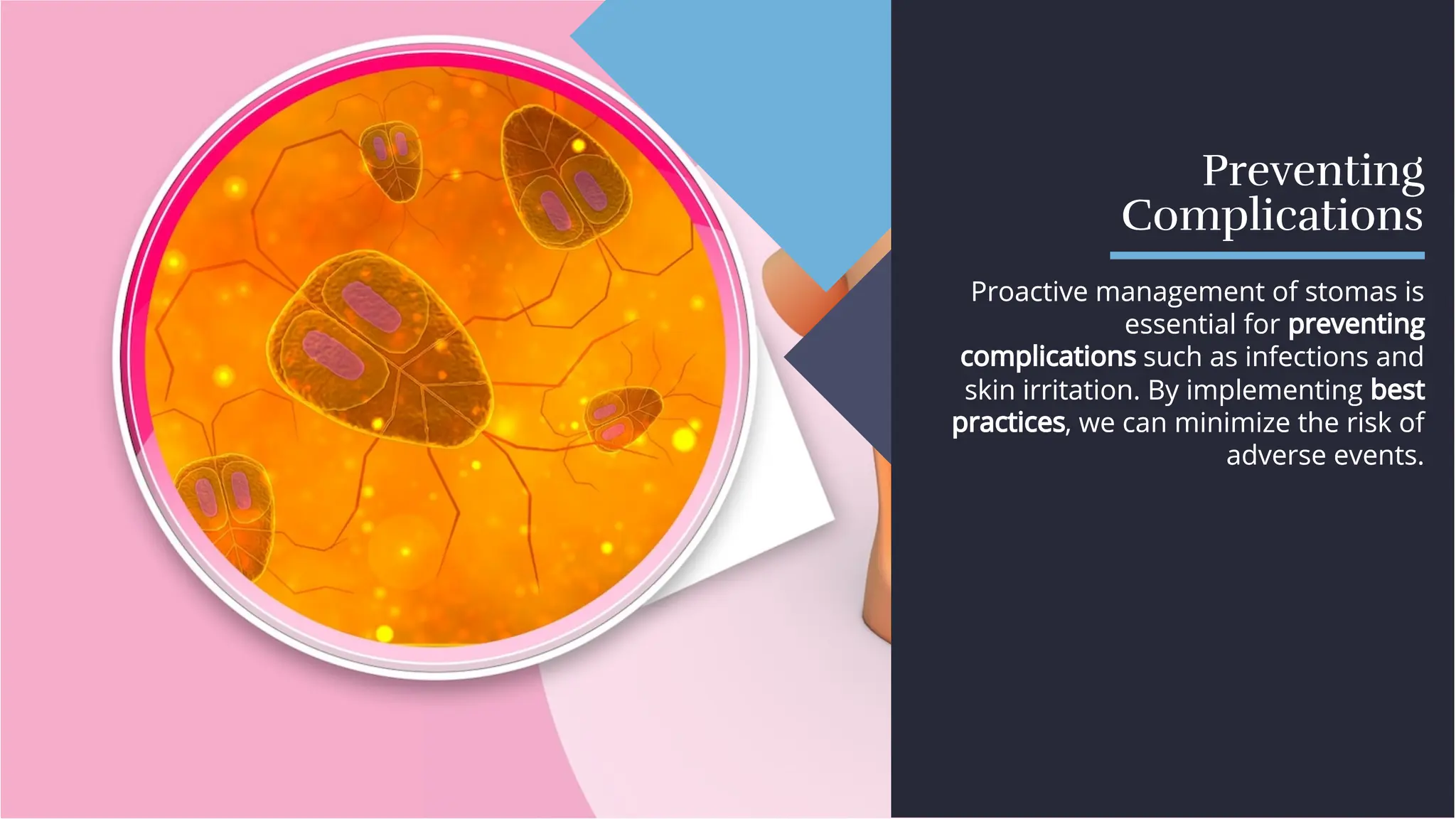 Stoma care presentation nursing guide and | PDF