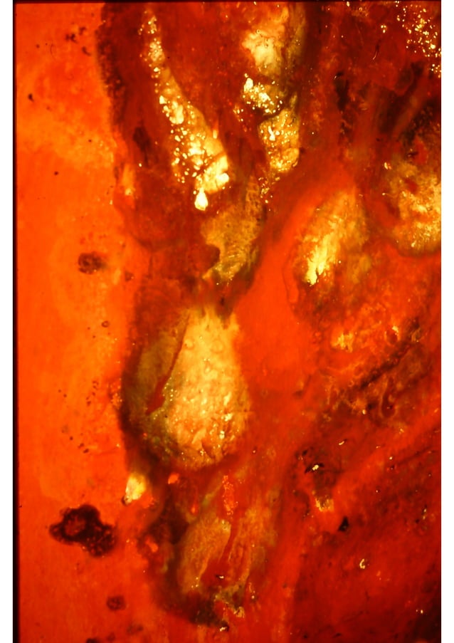 Acrylic structure | PDF